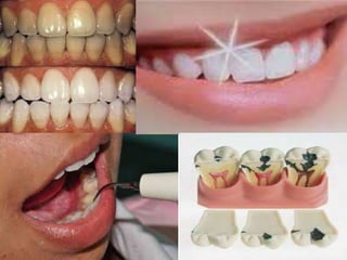 Kujdesi per gojen | PPT