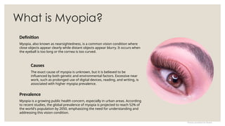 Understanding myopia and myopia's effects | PPTX