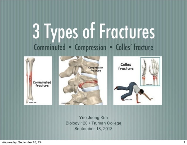 Biology 120: Module 04: 3 Types of Fractures