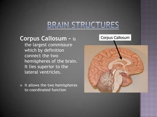 Biology 161 lab_7__brain_and_ventricles2 | PPTX