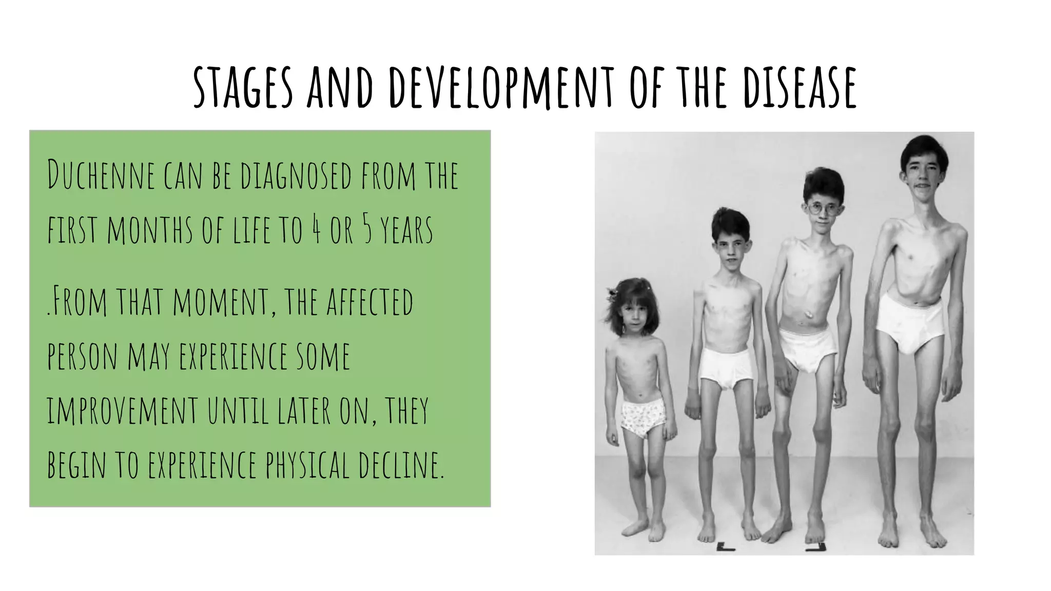 Rare Disease Day: DUCHENNE MUSCULAR DYSTROPHY | PPT