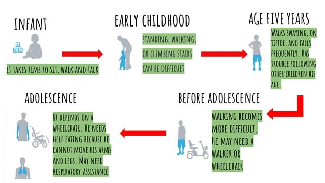Rare Disease Day: DUCHENNE MUSCULAR DYSTROPHY | PPT