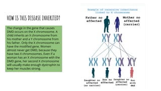 Rare Disease Day: DUCHENNE MUSCULAR DYSTROPHY | PPT