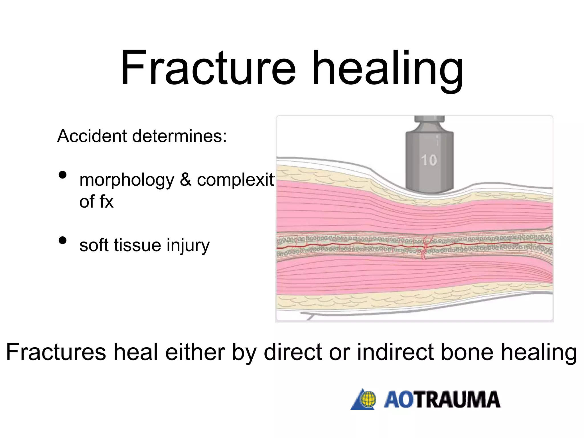 Biology of bone healing v2 | PPTX