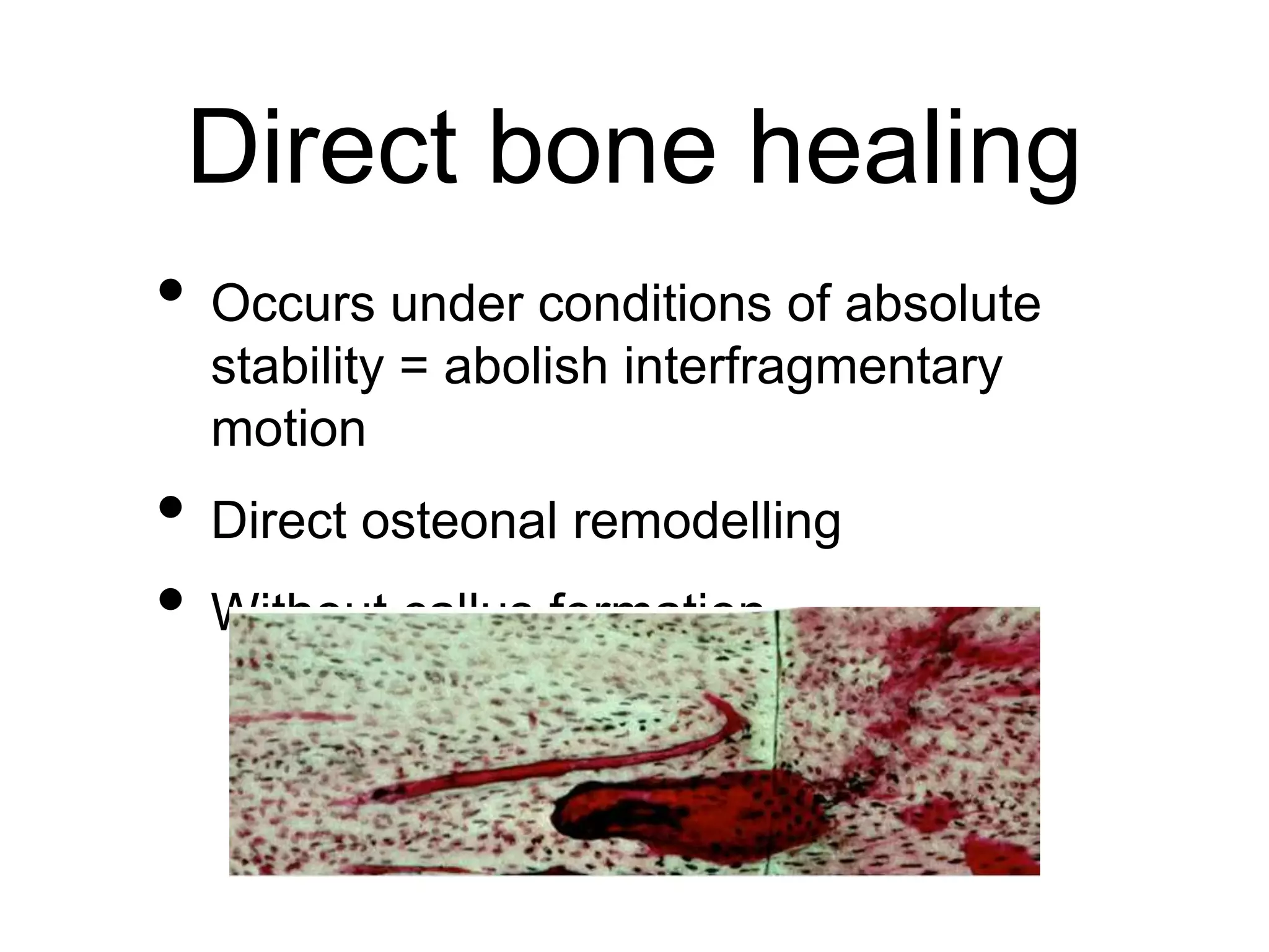 Biology of bone healing v2 | PPTX