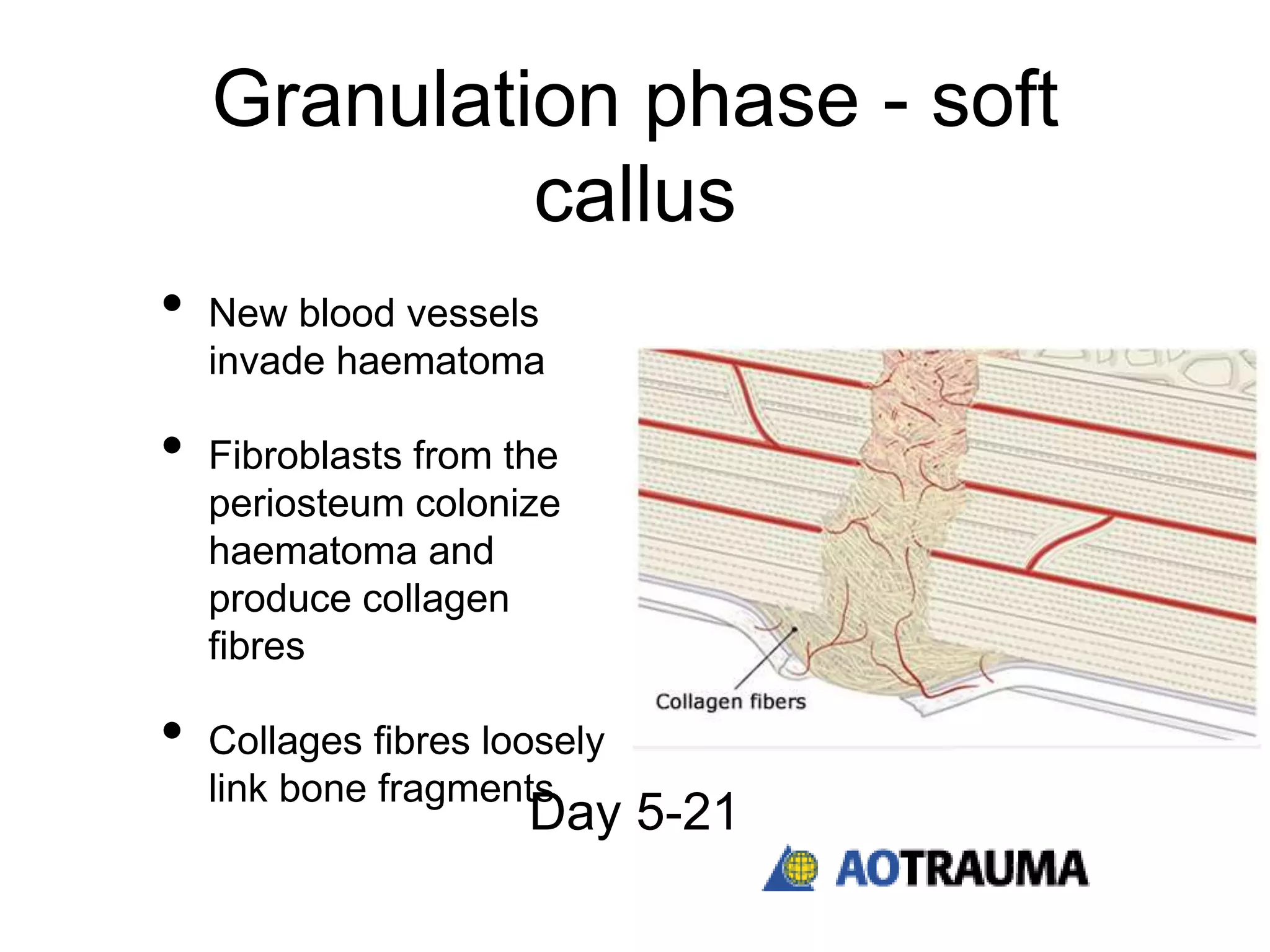 Biology of bone healing v2 | PPTX