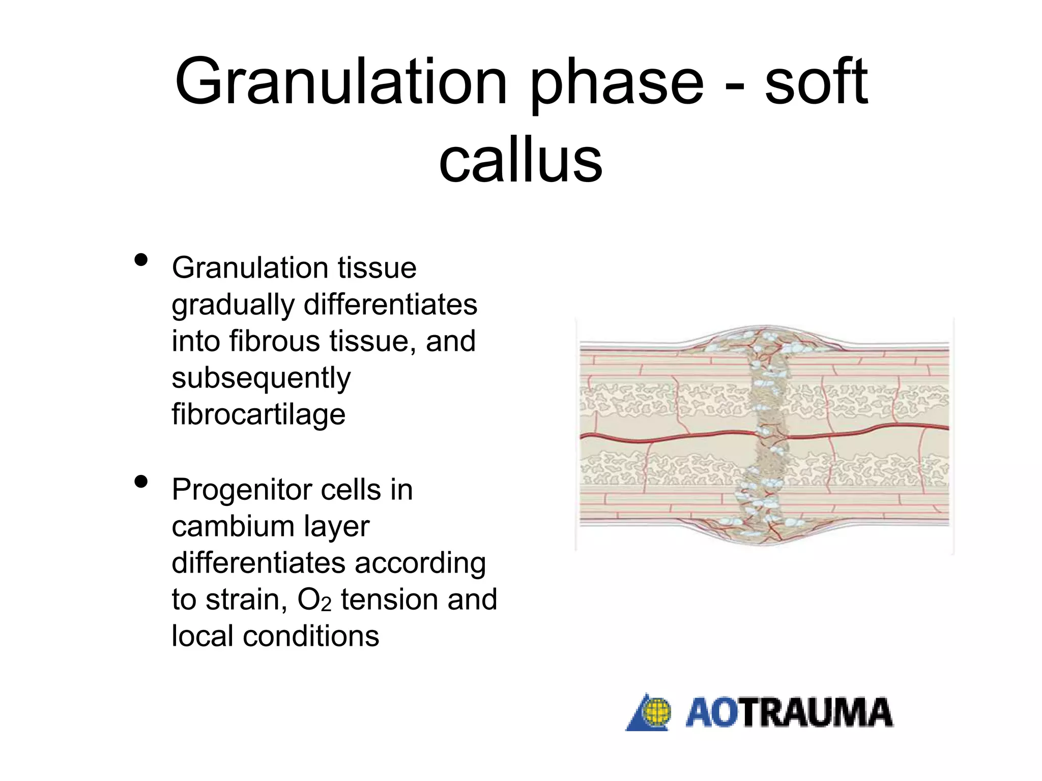 Biology of bone healing v2 | PPTX
