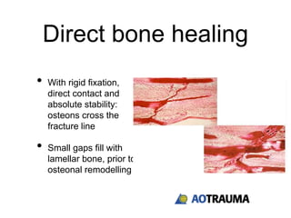 Biology of bone healing v2 | PPT