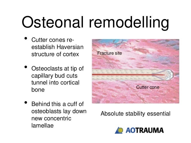 Biology of bone healing v2