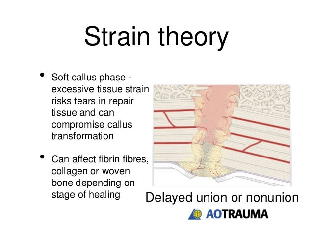 Biology of bone healing v2
