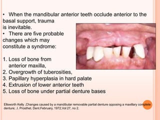 Biology of bone in complete dentures, removable partial denture ...