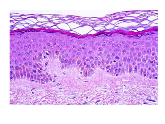 Biology of keratinocytes | PPTX | Skin and Dermatology | Diseases and ...