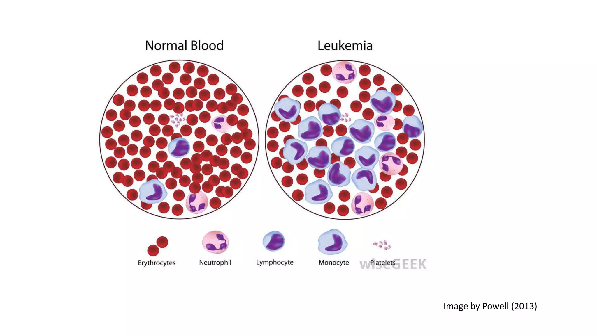 Biology of leukaemia | PPTX
