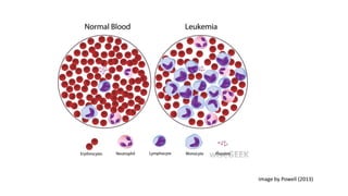 Biology of leukaemia | PPTX