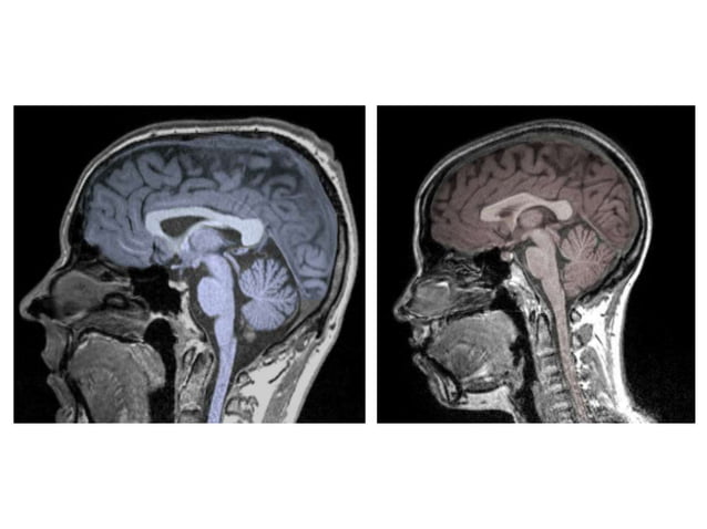 The Biology of Mental Illness | PPT