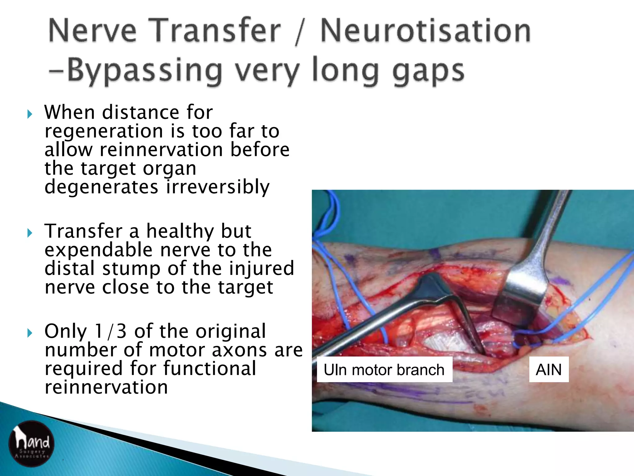 Biology of nerve injury and repair | PPTX