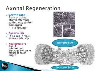 Biology of nerve injury and repair | PPTX