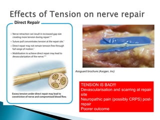 Biology of nerve injury and repair | PPTX