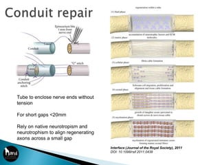 Biology of nerve injury and repair | PPTX