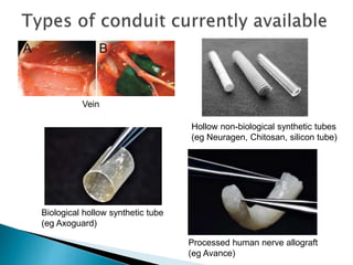 Biology of nerve injury and repair | PPTX