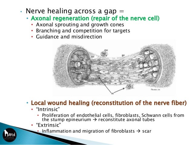 Biology of nerve injury and repair