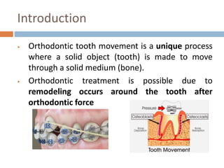biology of tooth movement (1).pptx