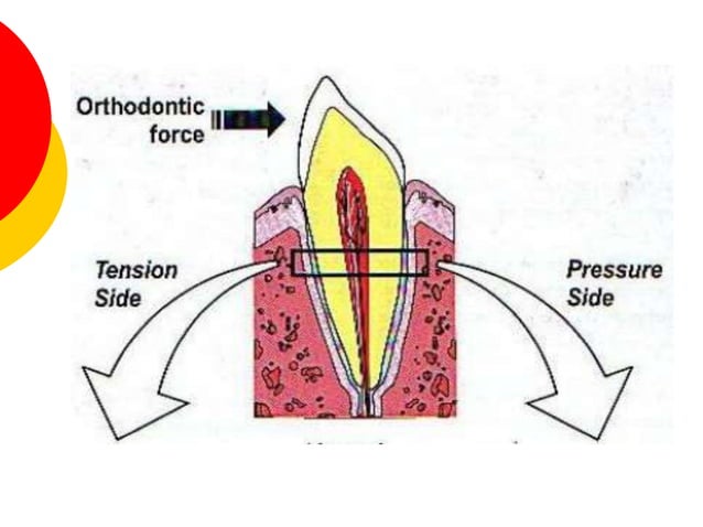 Biology of orthodontic tooth movement | PPT | Bone and Joint Conditions ...
