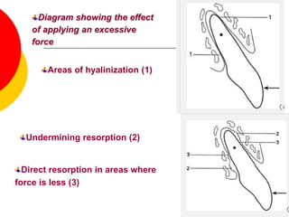 Biology of orthodontic tooth movement | PPT