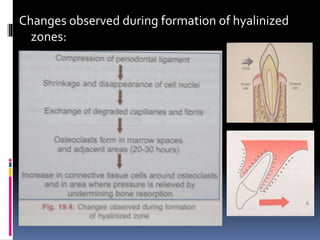 Biology of tooth movement O.ppt | Dental Health | Diseases and Conditions