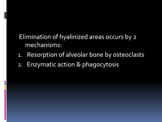 Biology of tooth movement O.ppt | Dental Health | Diseases and Conditions