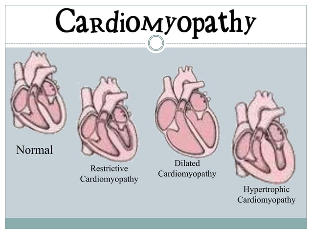 Diseases of the Circulatory System | PPTX