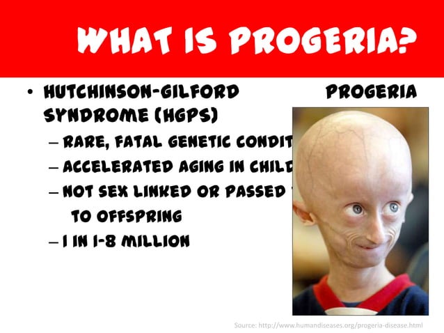 Biology project progeria | PPTX | Heart and Cardiovascular Diseases | Diseases and Conditions