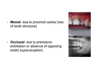 Biology tooth movement.pptx | Dental Health | Diseases and Conditions