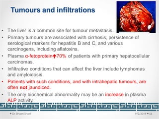 Unit 6: Liver function & investigations of liver disease | PDF
