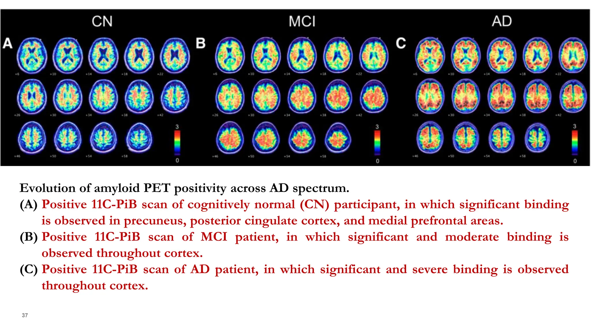 Role of Biomarkers in Alzheimers Disease | PPTX