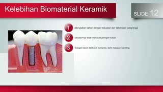 Biomaterial | PPTX