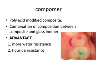 Biomaterial2 final | PPT