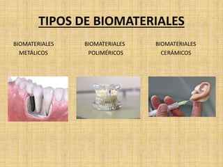 Biomateriales | PPTX