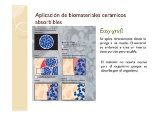 Biomateriales.pdf