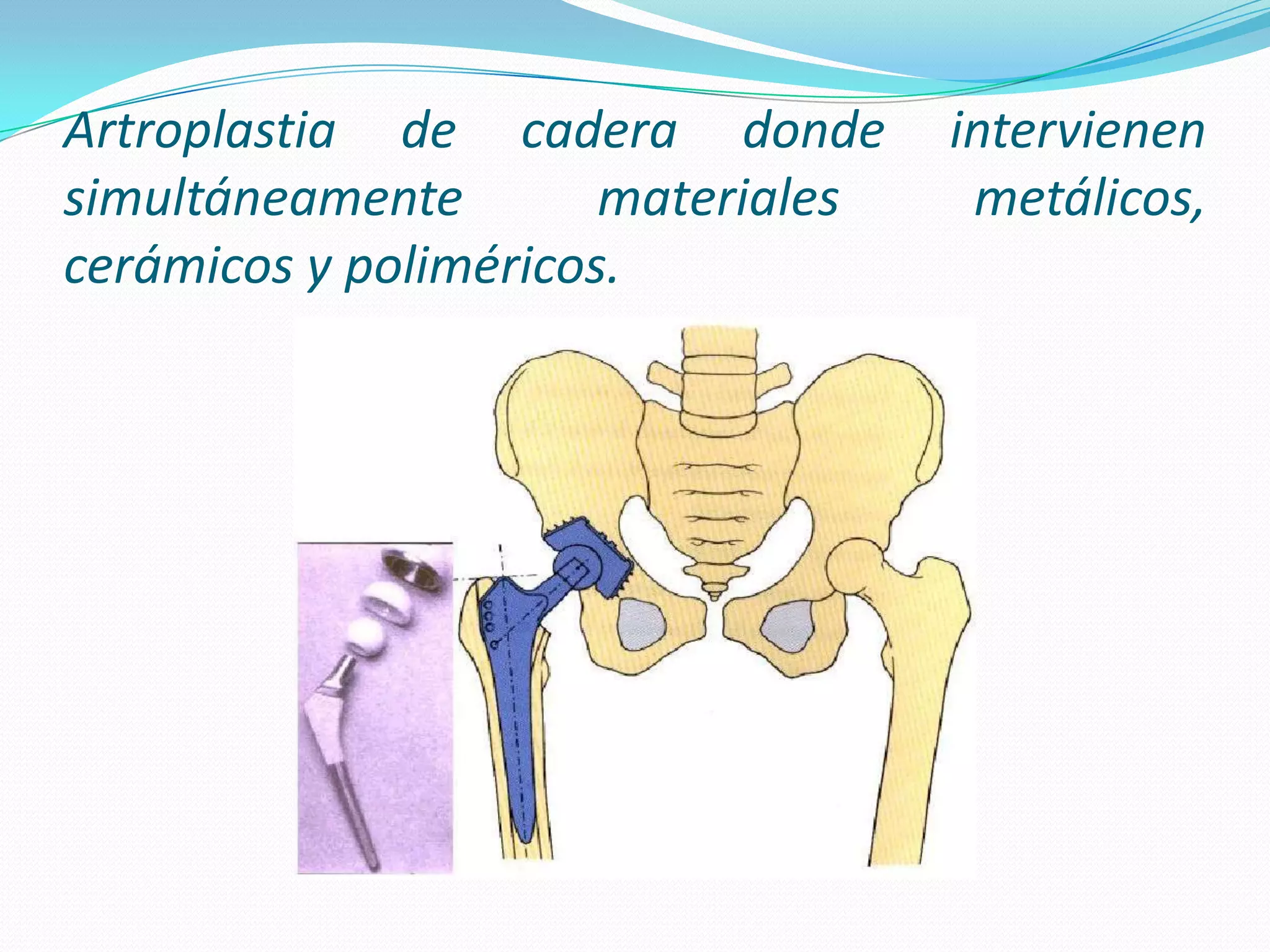 Biomateriales ceramícos | PPTX