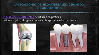Biomateriales terminado natalia y anabel | PPTX
