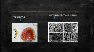 Biomateriales terminado natalia y anabel | PPTX
