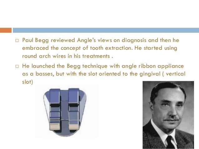 About Orthodontic Brackets