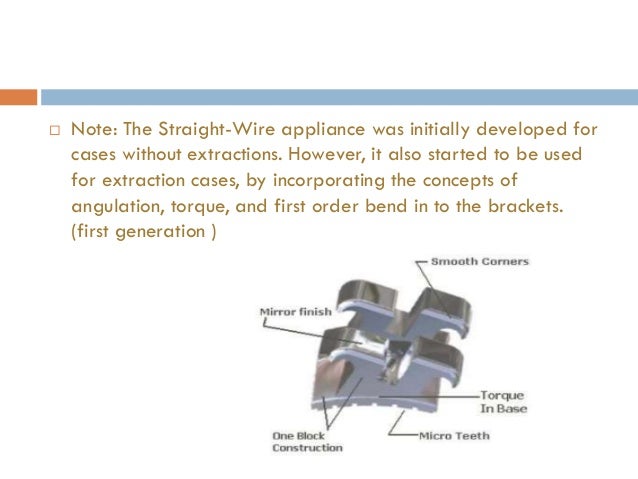 Straight Wire Tooth Bracket : Straight Wire Braces help in Straight ...