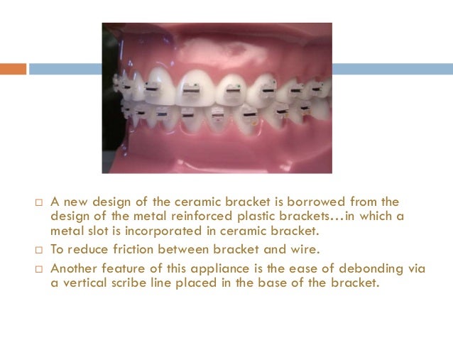 Orthodontic Brackets