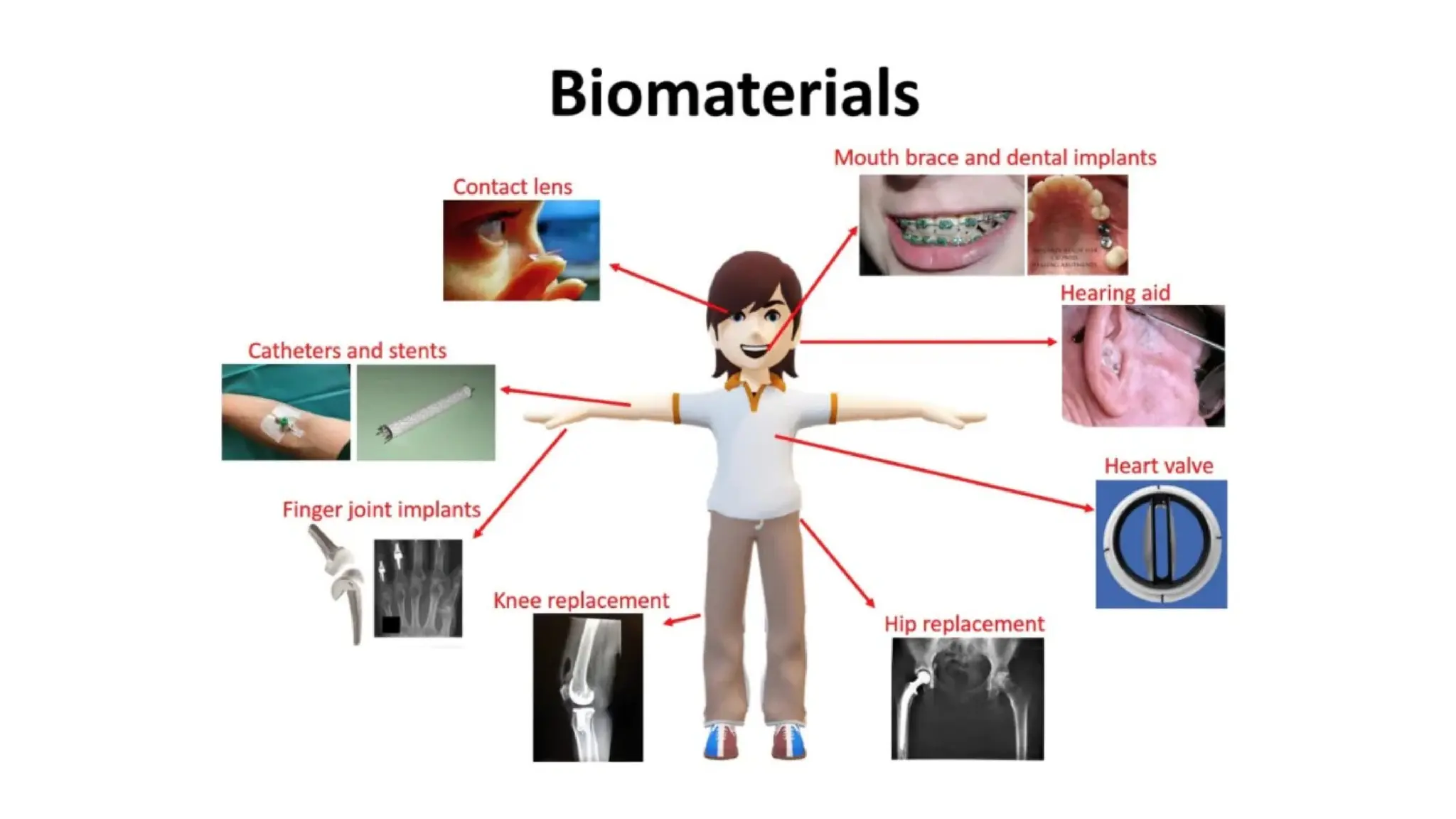 Biomaterials.BiomaterialsBiomaterialsBiomaterialsBiomaterialsBiomaterialsBiomaterials | PPTX