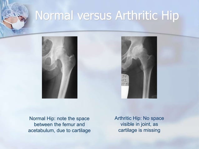 Biomedical Engineering Biomaterials_1.ppt