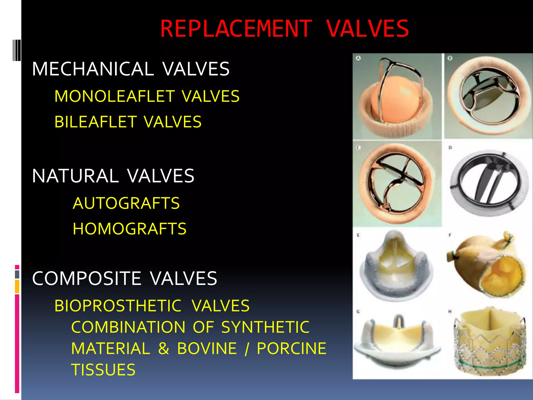 Biomaterials for Cardiovascular and Thoracic surgery | PPTX