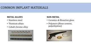 BIOMATERIALS IN ORTHOPAEDICS-1 (1).pptx