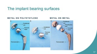 Biomaterials in Orthopedics.pptx